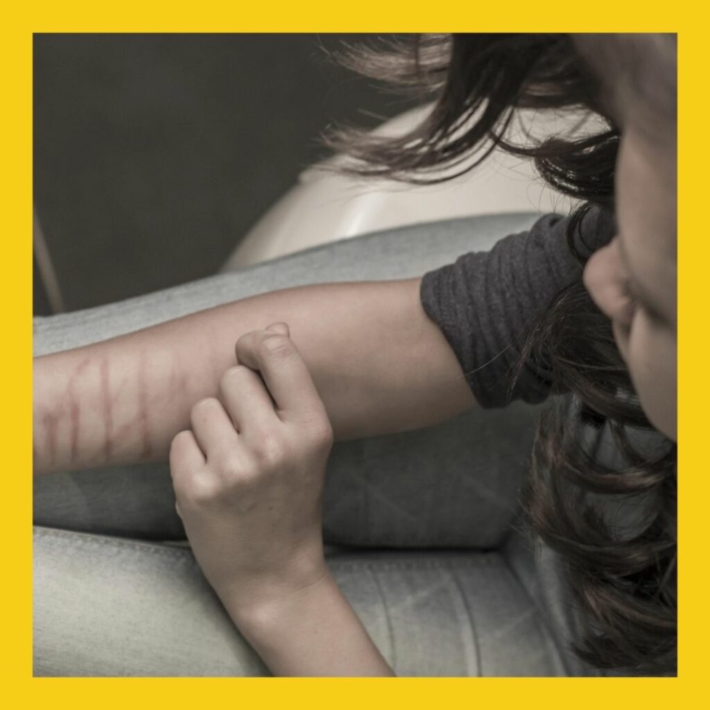 Automutilation des adolescents - Guide des parents